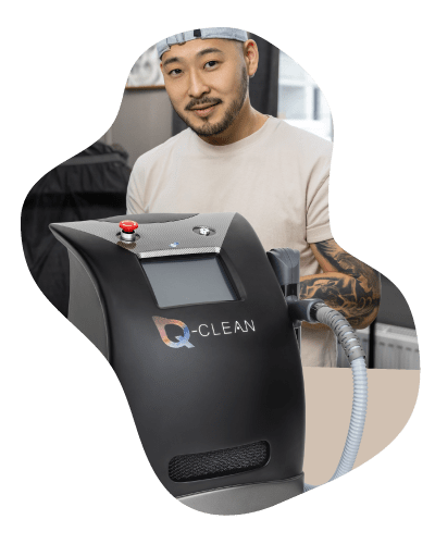 Locação de Equipamento Para Remoção de Tatuagem, Micropigmentação ...